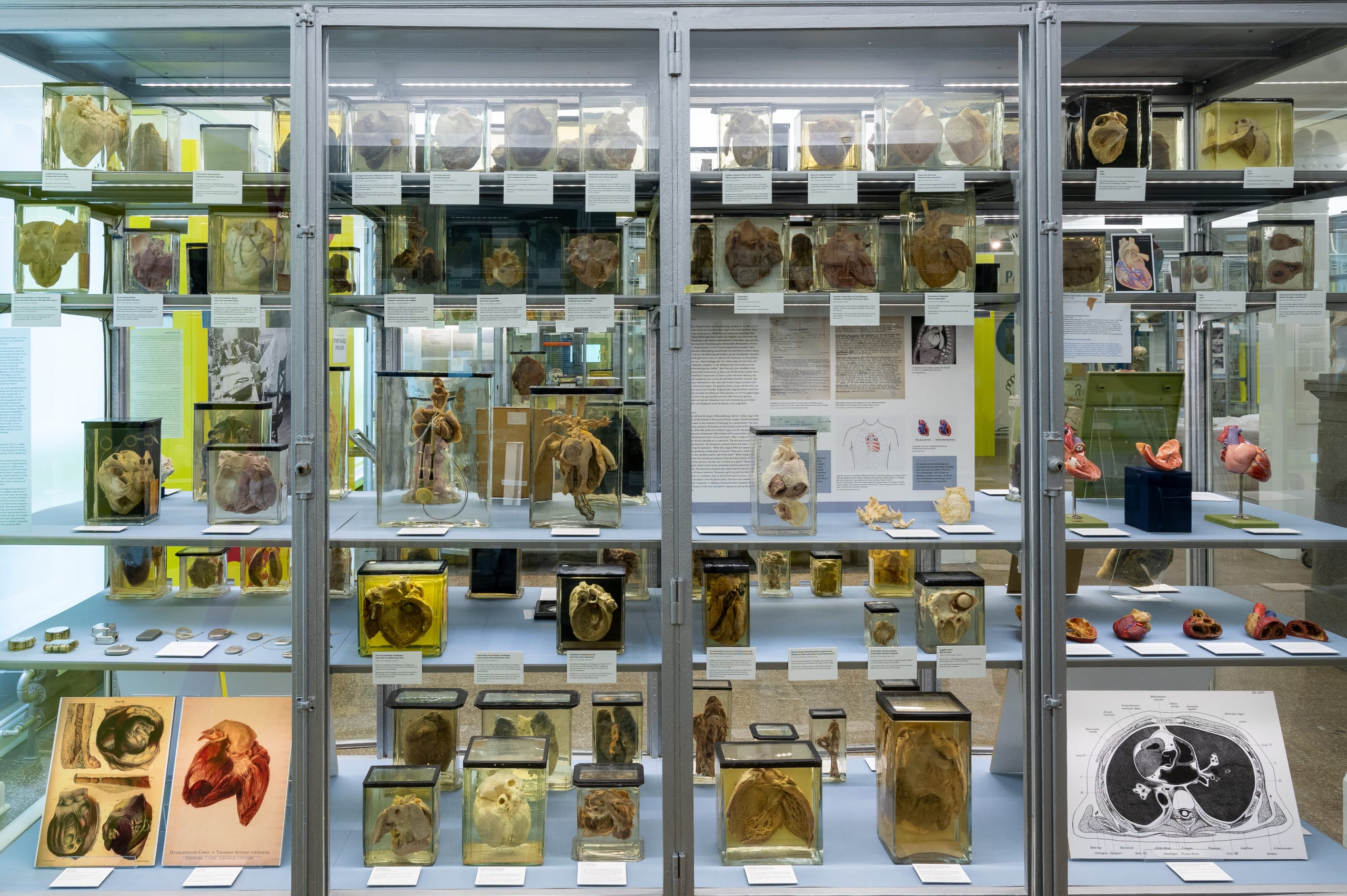 Wieder geöffnet: Berliner Medizinhistorisches Museum - Health&Care ...